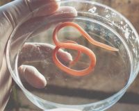 Hlístice: popis parazitů, hlavní příznaky a principy terapie